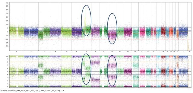 Affymetrix OncoScan FFPE检测CNV